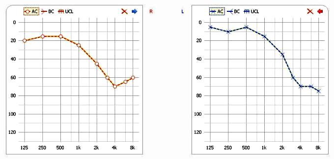 Intensité sonore et niveau sonore.Les dangers liés au son - accesmad